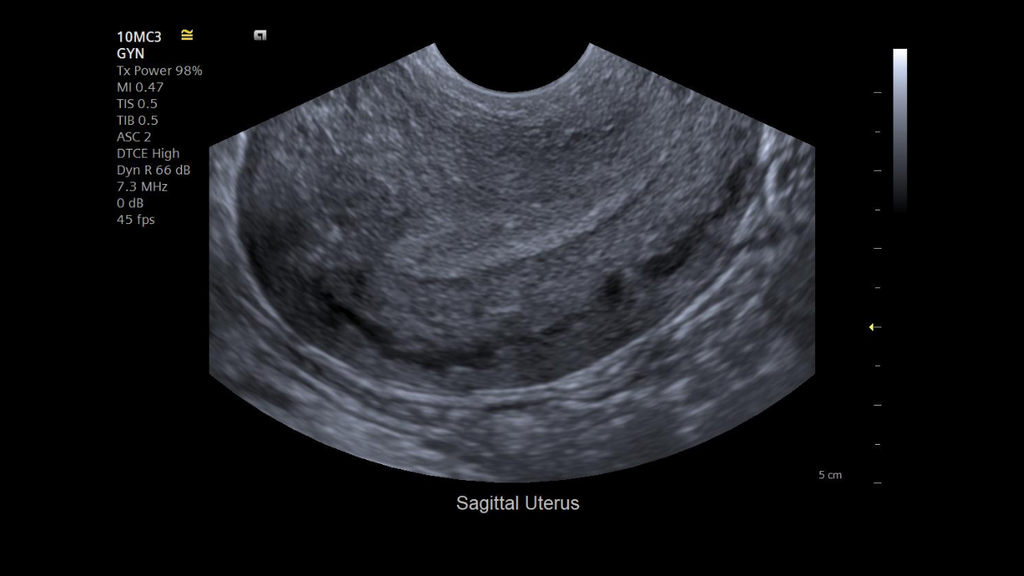 ACUSON Maple is a High-Performance Shared Service Ultrasound System ...