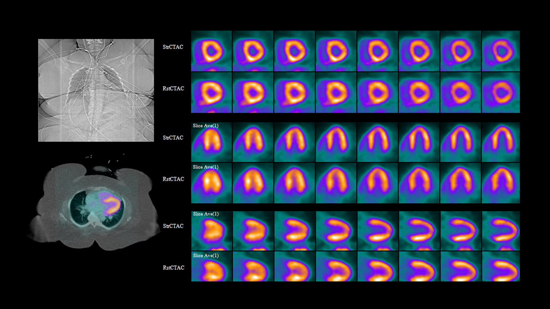 Biograph Horizon PET/CT scanner - Siemens Healthineers