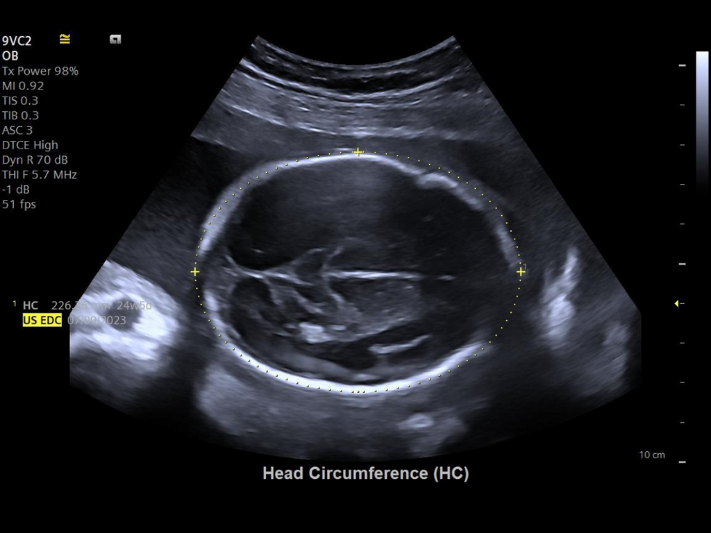 ACUSON Maple is a High-Performance Shared Service Ultrasound System ...