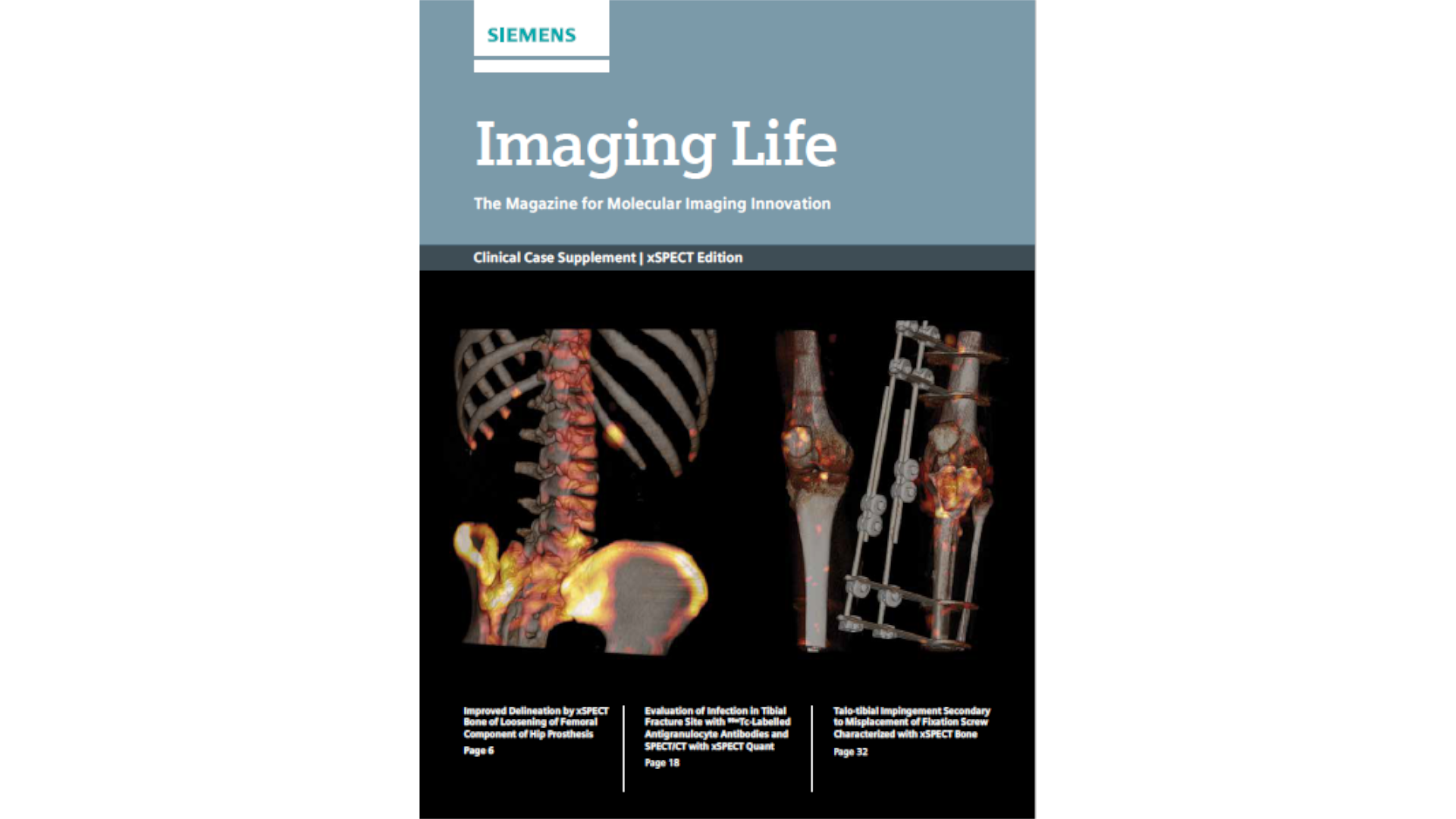 Imaging Life Publication Archive - Siemens Healthineers Imaging Life Publication Archive - Siemens Healthineers
