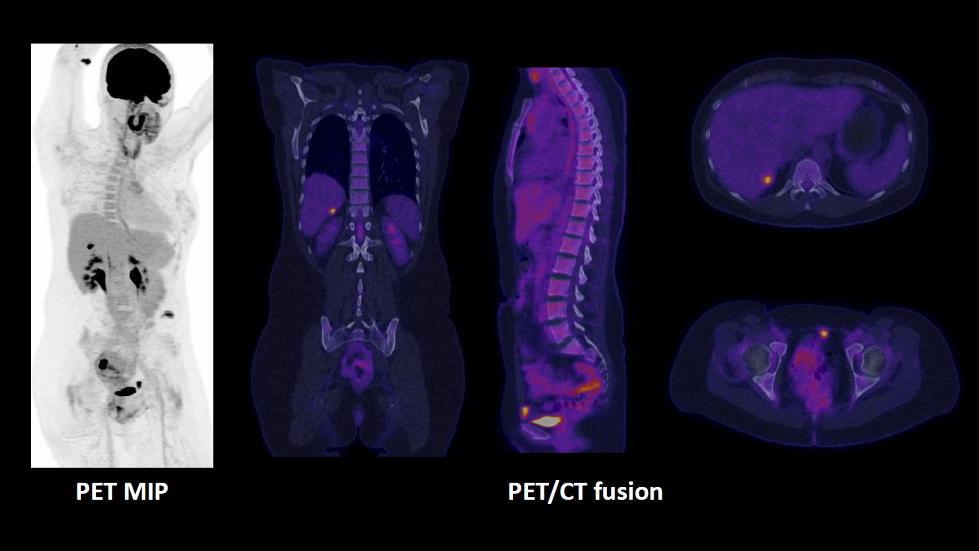 Biograph Vision PET/CT Scanner - Siemens Healthineers