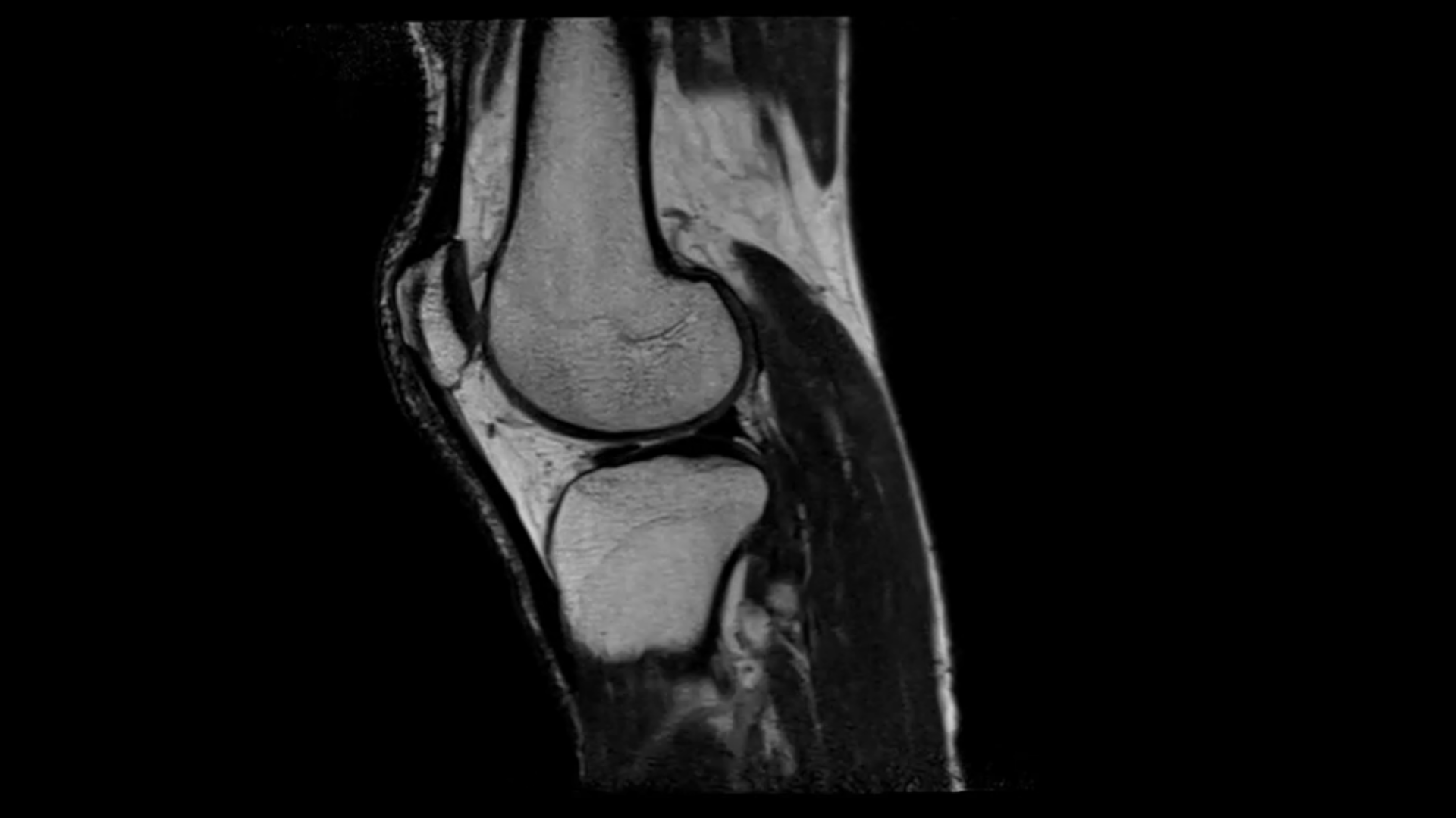 MAGNETOM Free.Star - Siemens Healthineers USA