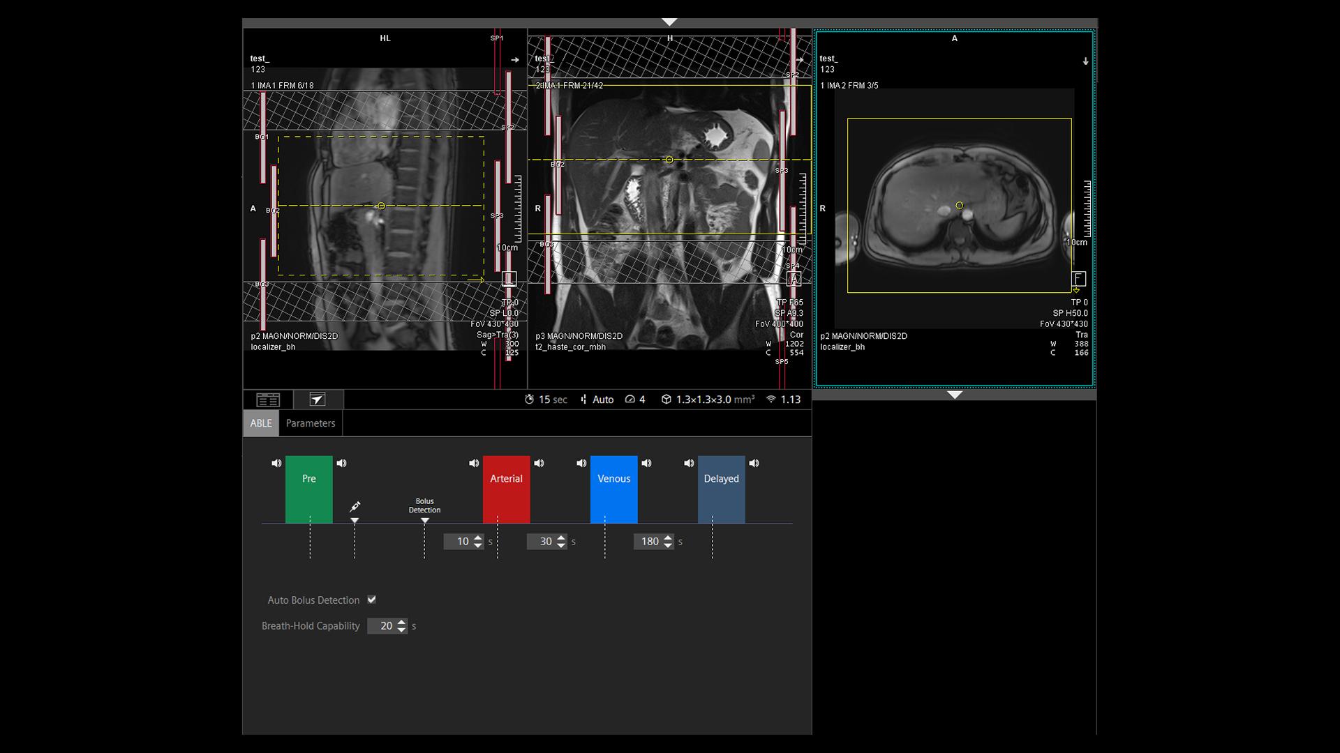 myExam Companion - Siemens Healthineers