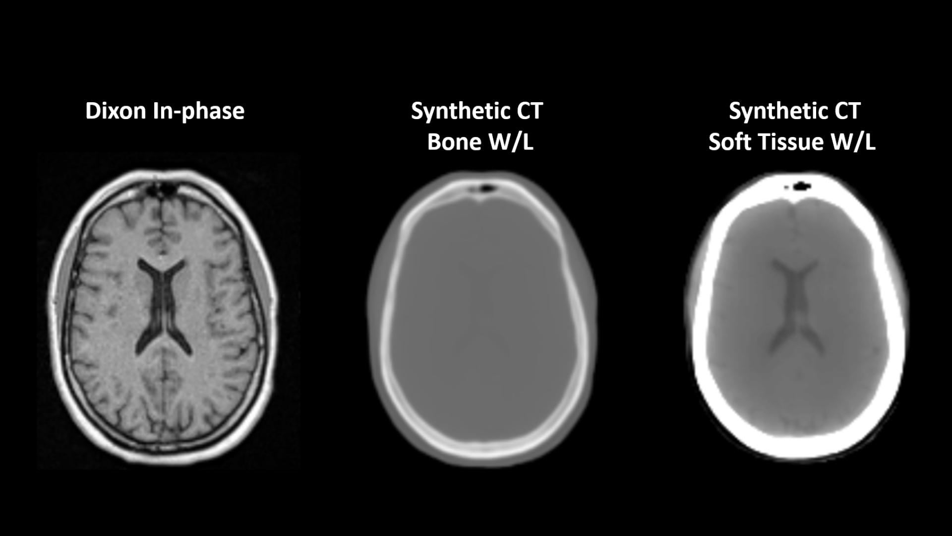 MAGNETOM Flow RT Pro Edition - Siemens Healthineers