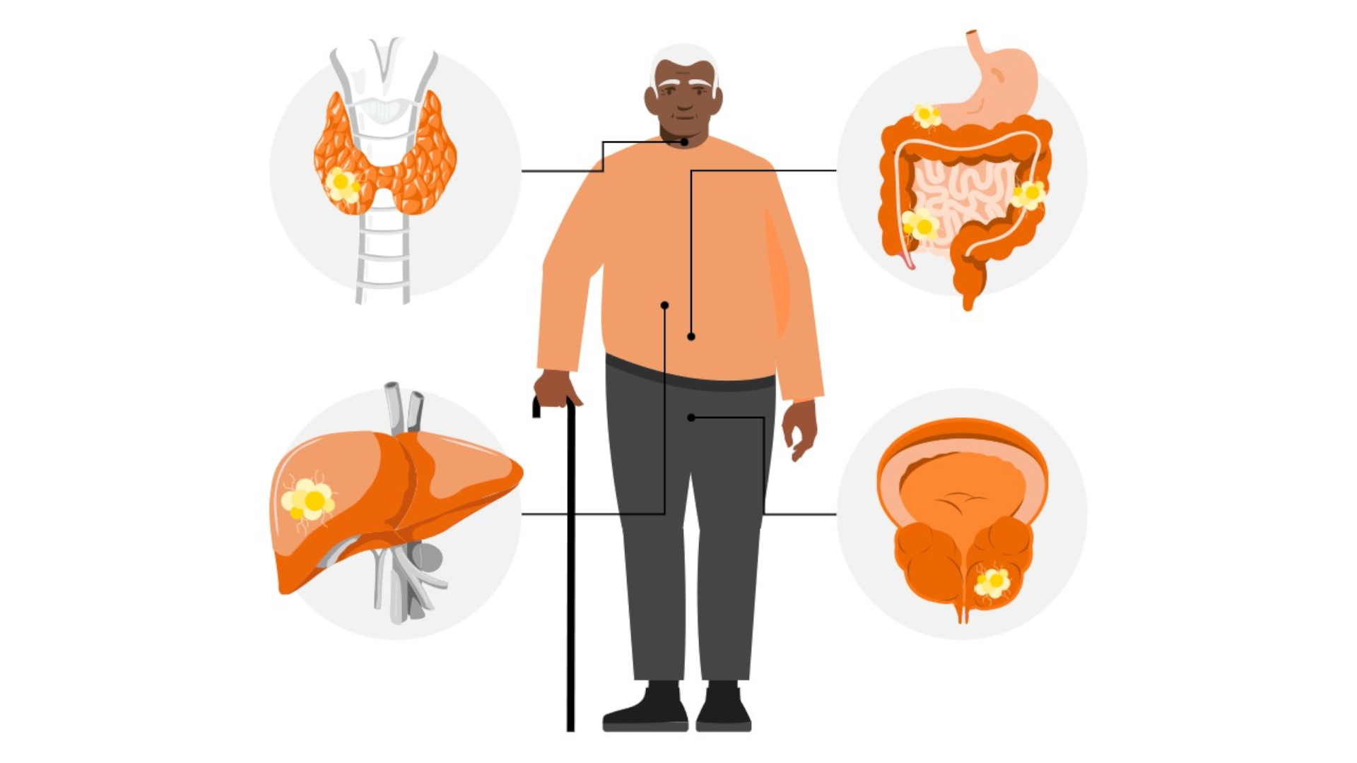What is theranostics? - Siemens Healthineers USA