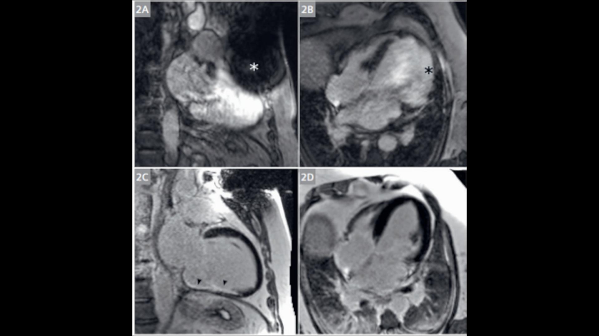 MAGNETOM Sola Cardiovascular Edition - Siemens Healthineers USA