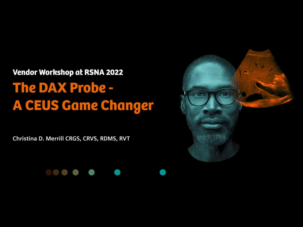 ACUSON Ultrasound Machines