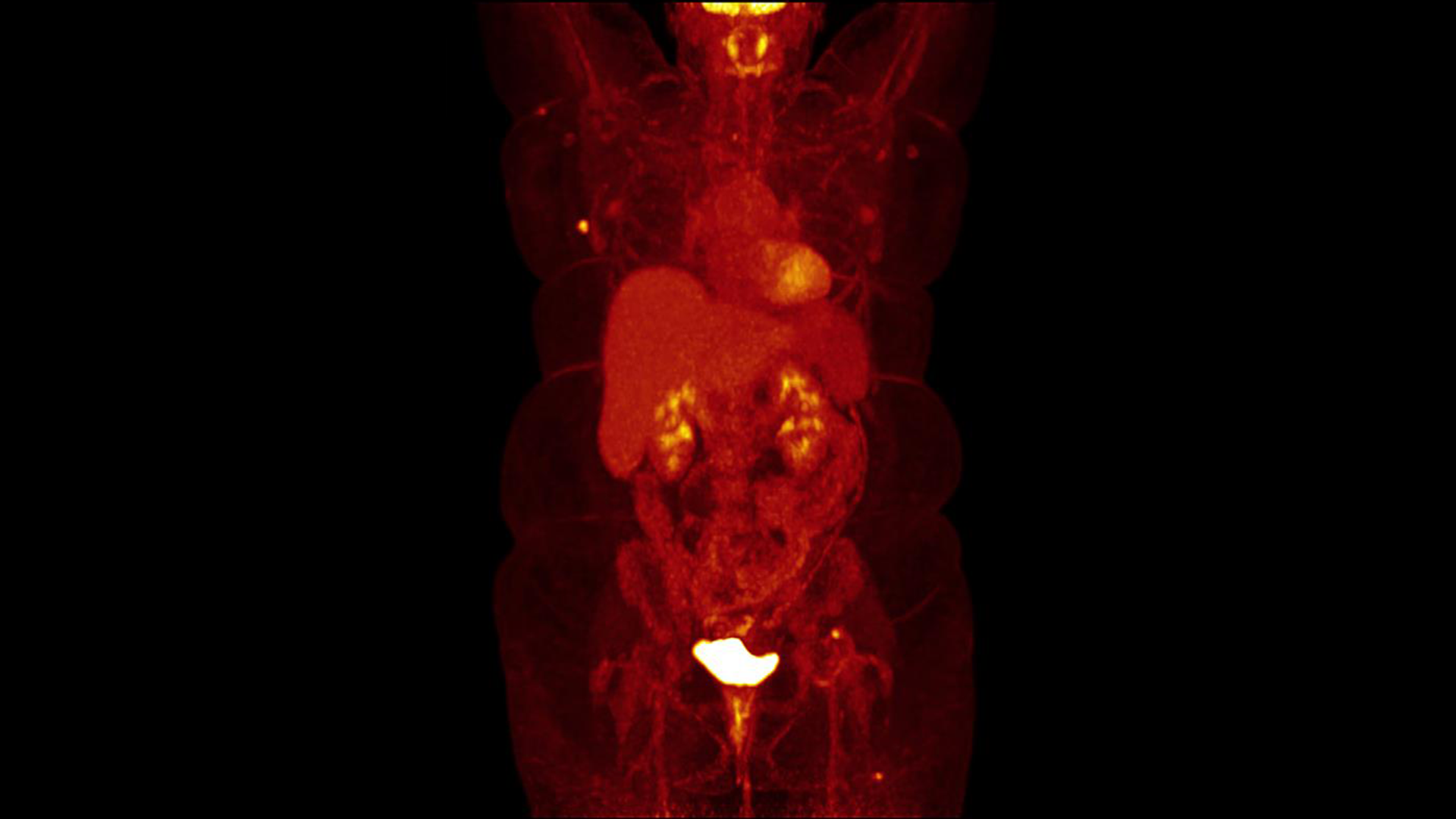 Molecular Imaging - Siemens Healthineers