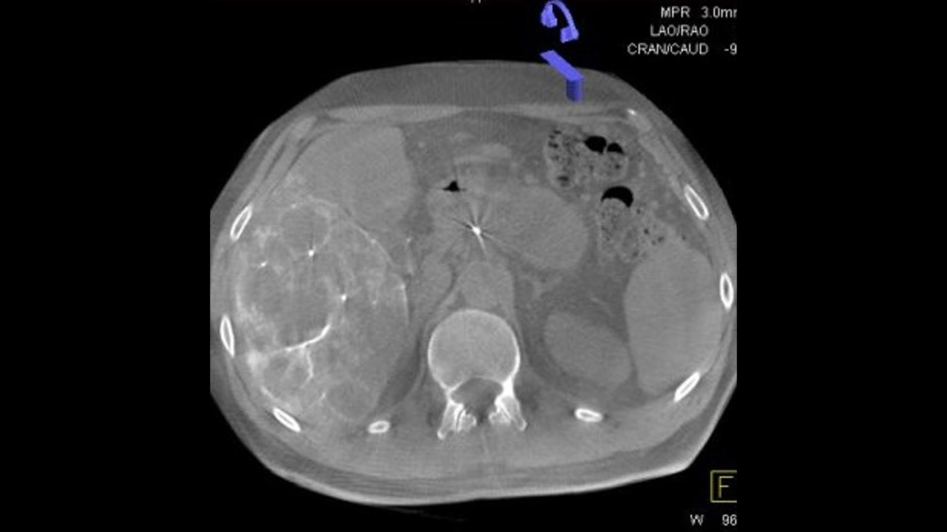 syngo DynaCT - Siemens Healthineers Japan