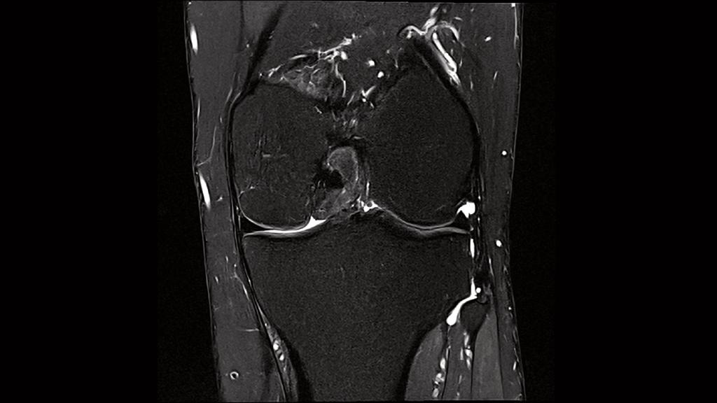 MAGNETOM Cima.X - Make the difference. - Siemens Healthineers