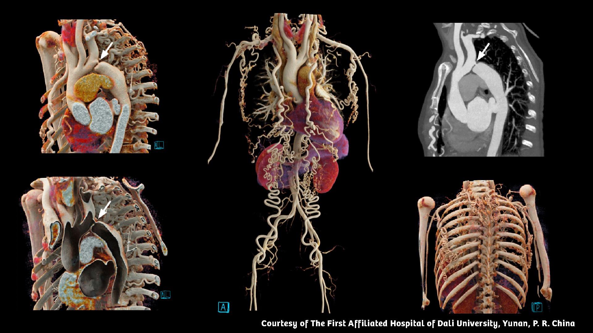 Contrast media - Siemens Healthineers