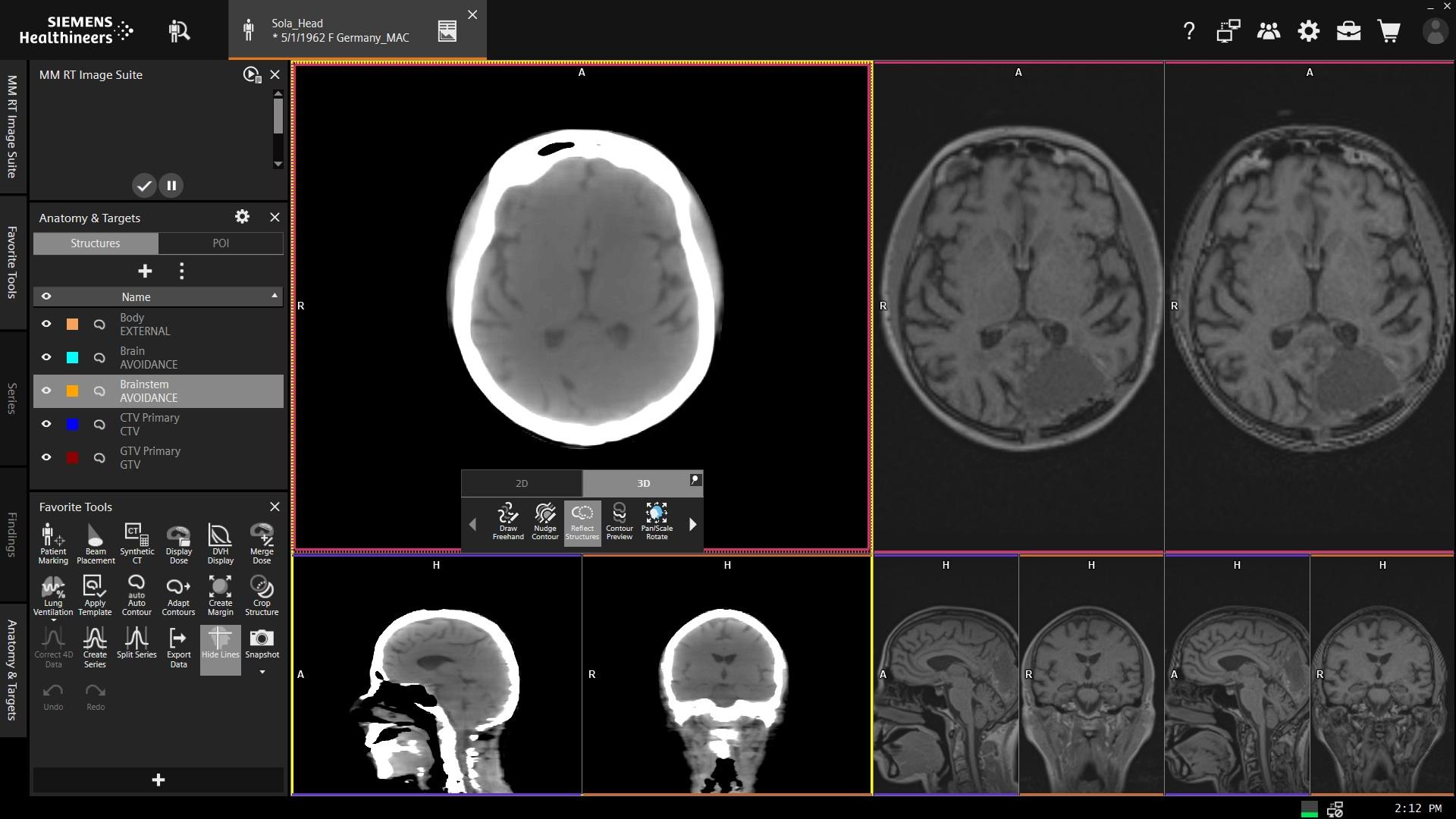 syngo.via RT Image Suite - Siemens Healthineers
