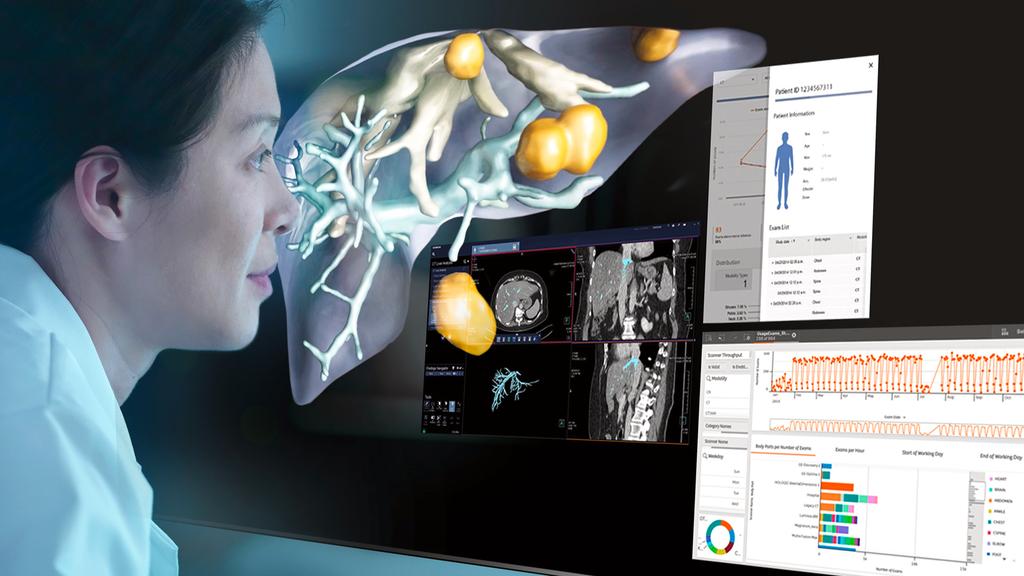 Liver Cancer Management - Siemens Healthineers