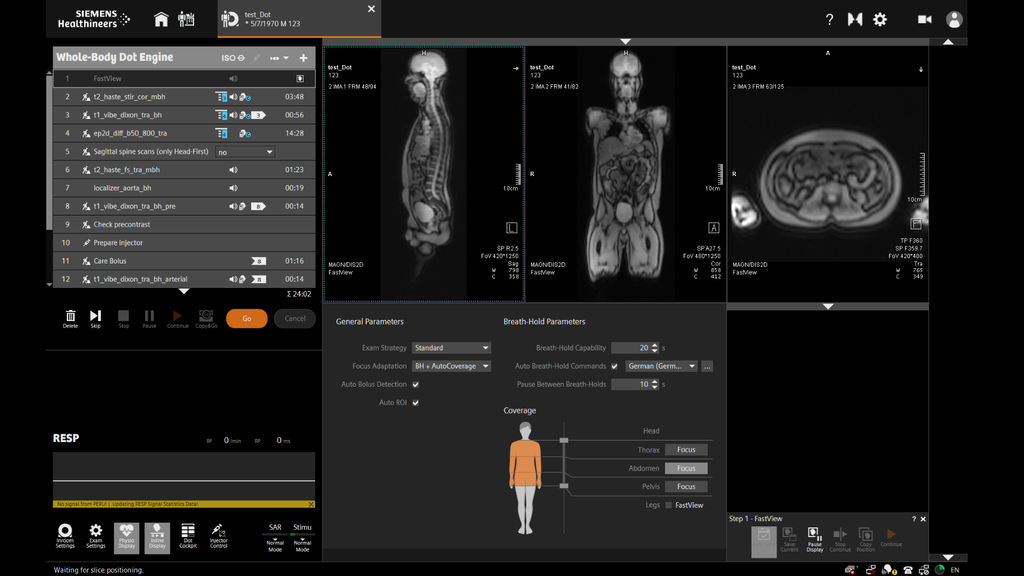 Excelerate Edition Upgrade