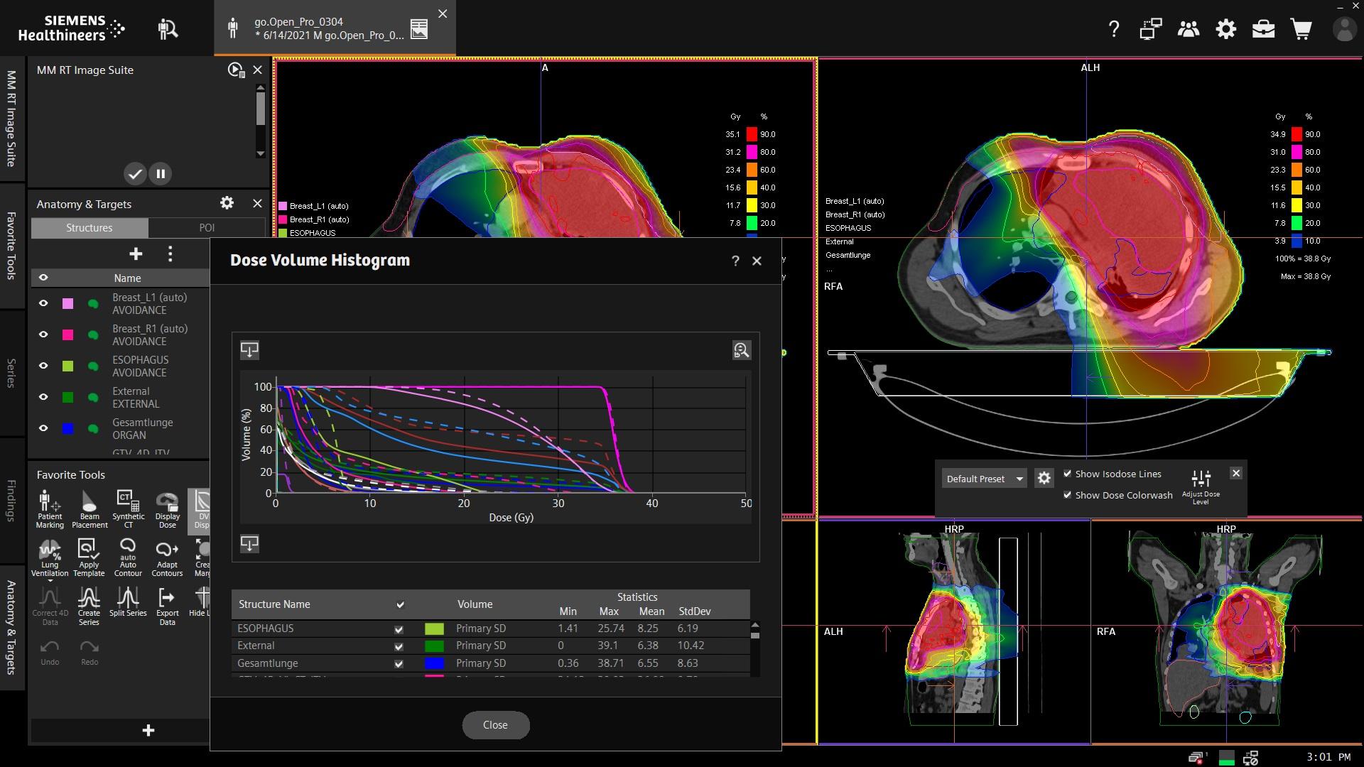 syngo.via RT Image Suite - Siemens Healthineers