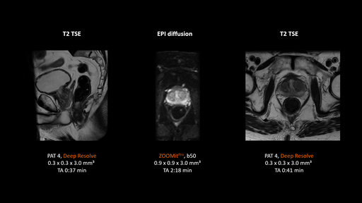 Exceleration Edition - Siemens Healthineers