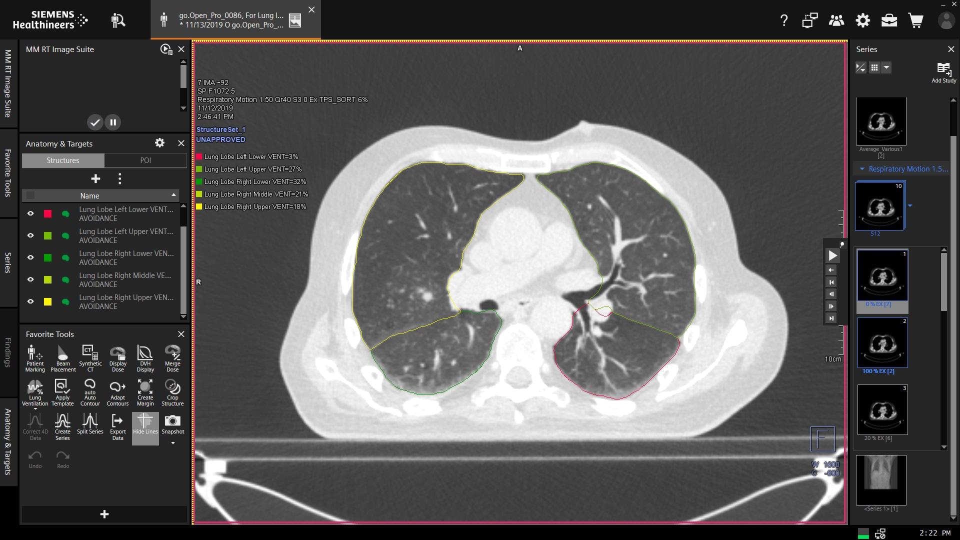 syngo.via RT Image Suite - Siemens Healthineers