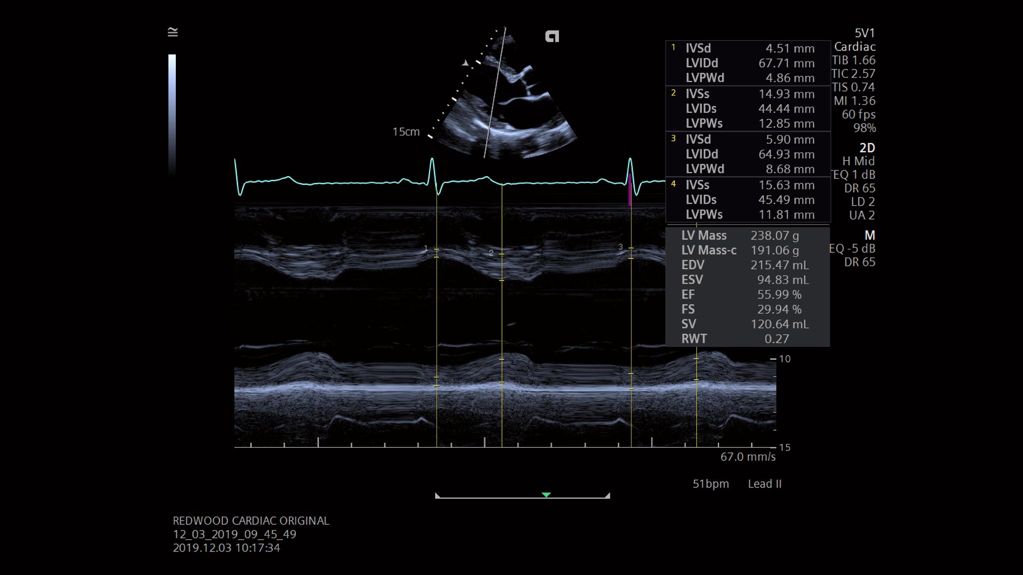 A New Era for Cardiac Ultrasound - Siemens Healthineers Malaysia