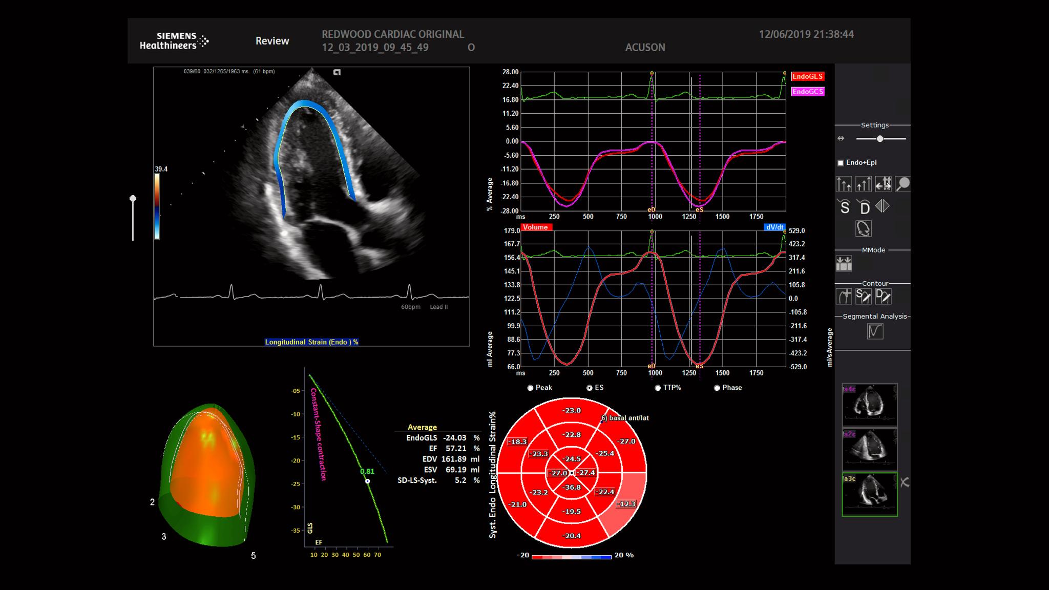A New Era for Cardiac Ultrasound - Siemens Healthineers Malaysia