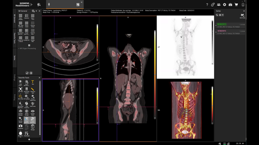 syngo.via - Siemens Healthineers USA