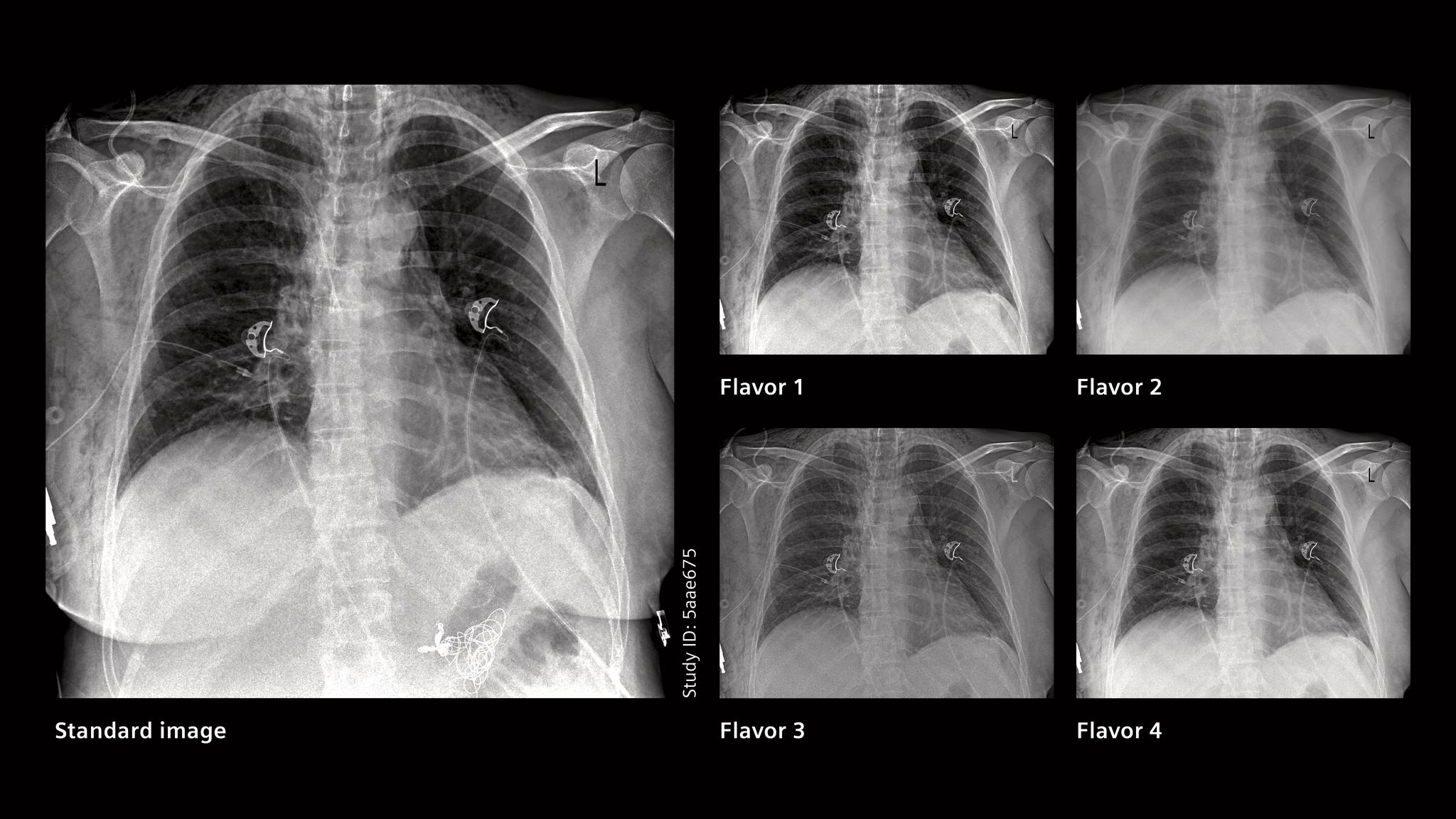 MOBILETT Impact - Siemens Healthineers