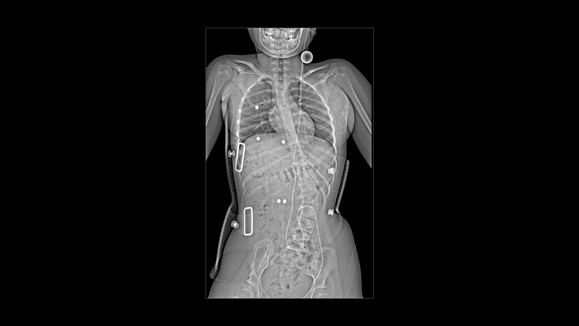 Twin Robotic X-ray scanner – Multitom Rax - Siemens Healthineers