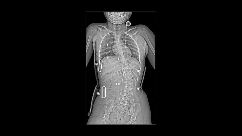 Twin Robotic X-ray scanner – Multitom Rax - Siemens Healthineers