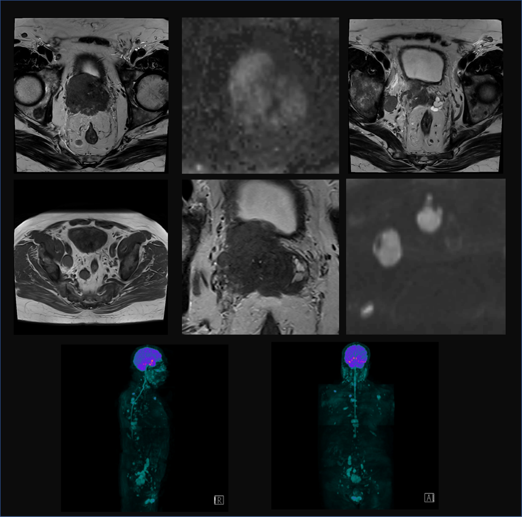 Introducing 3T MR Imaging with the New MAGNETOM Vida