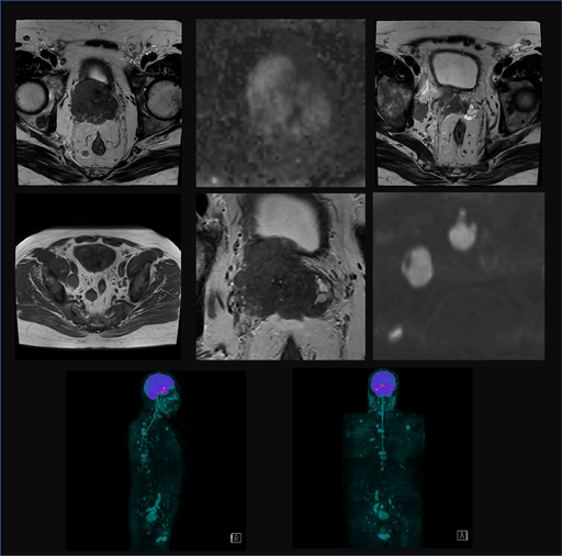 Introducing 3T MR Imaging with the New MAGNETOM Vida