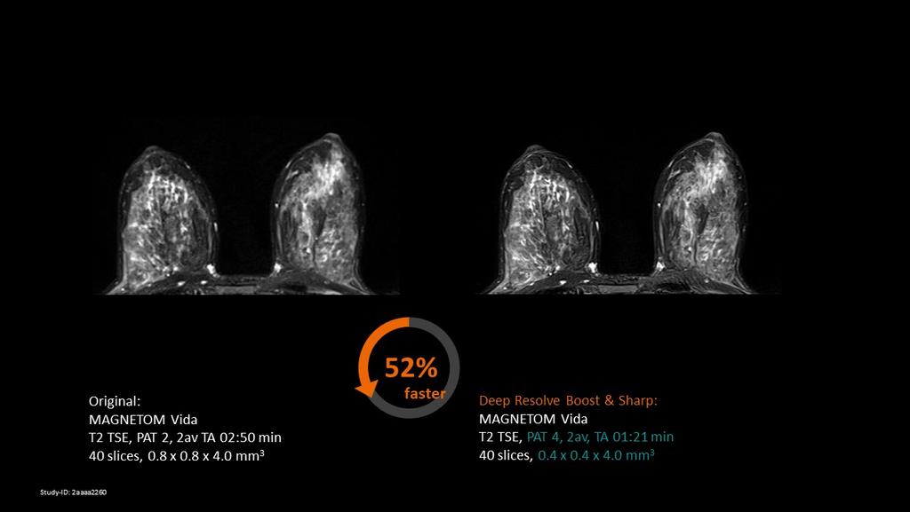Deep Resolve - Siemens Healthineers Japan