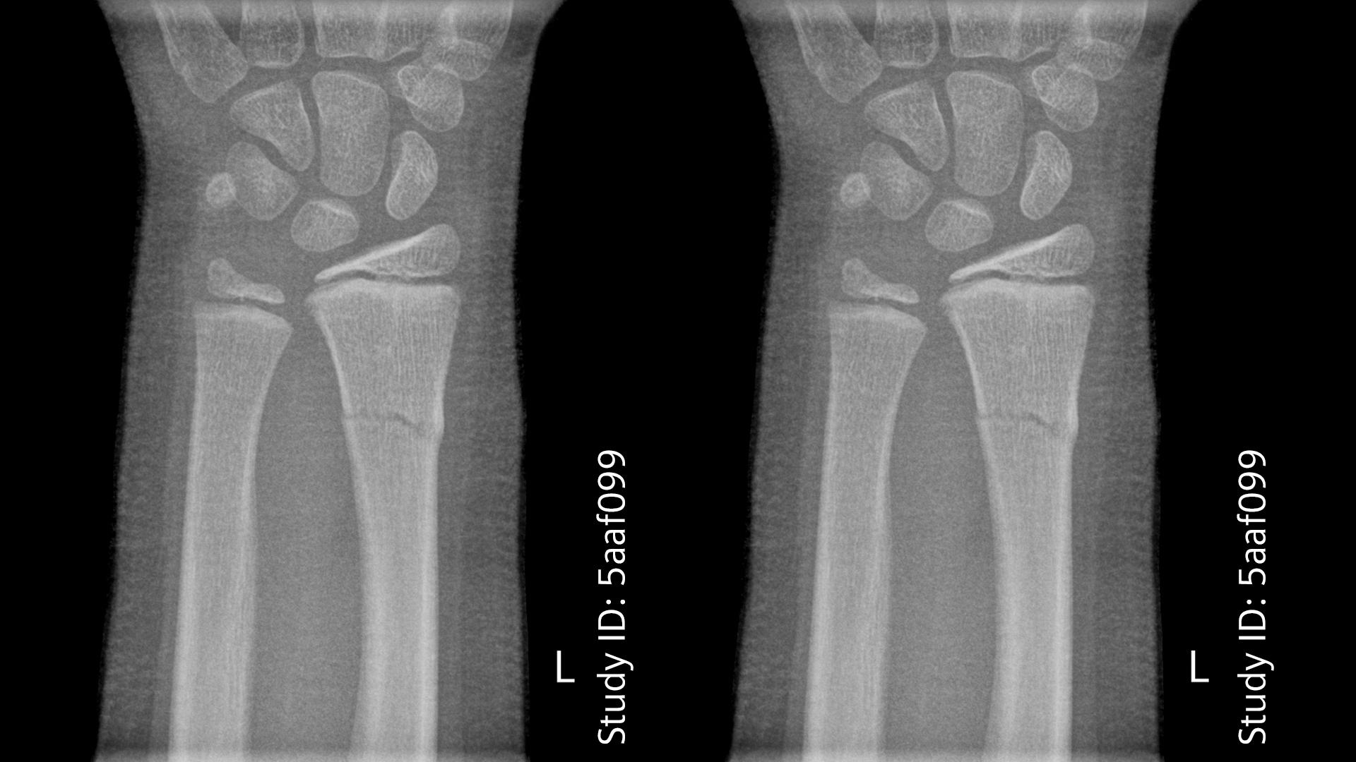 YSIO X.pree – Intelligence for excellence - Siemens Healthineers