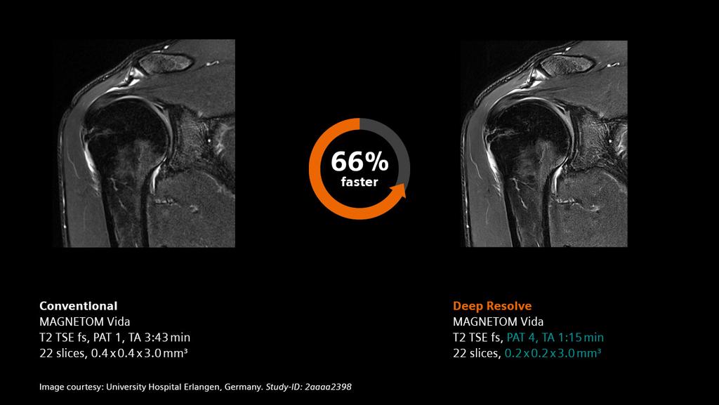 Deep Resolve - Siemens Healthineers