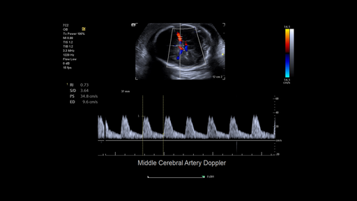 ACUSON Juniper Ultrasound System - Siemens Healthineers USA