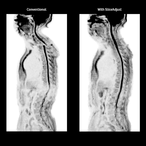 BioMatrix Technology - Siemens Healthineers India