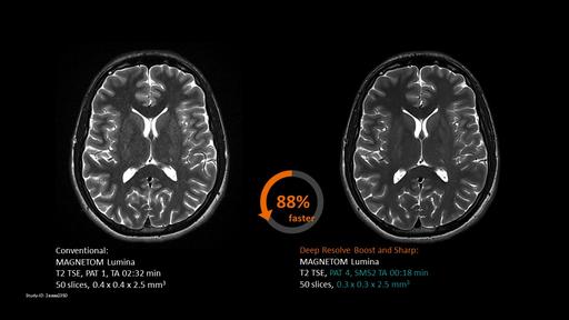 Deep Resolve - Siemens Healthineers