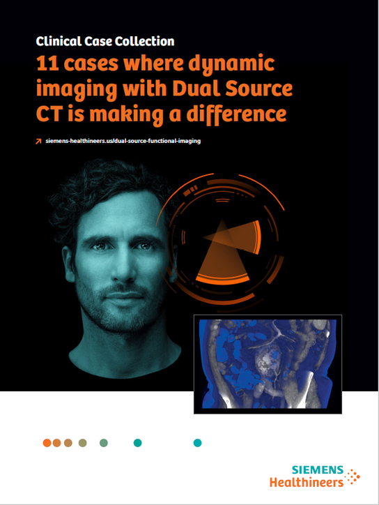 Dual Source CT in functional imaging - Siemens Healthineers USA
