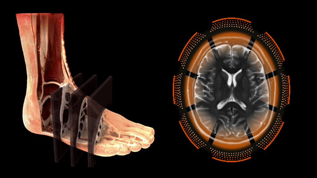 Human centered MRI - Patient experience