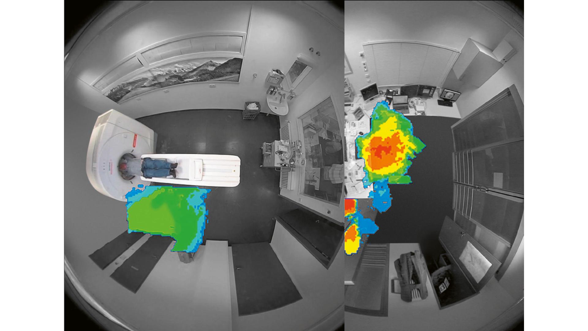 SOMATOM go.Top com myExam Companion - Siemens Healthineers Brasil