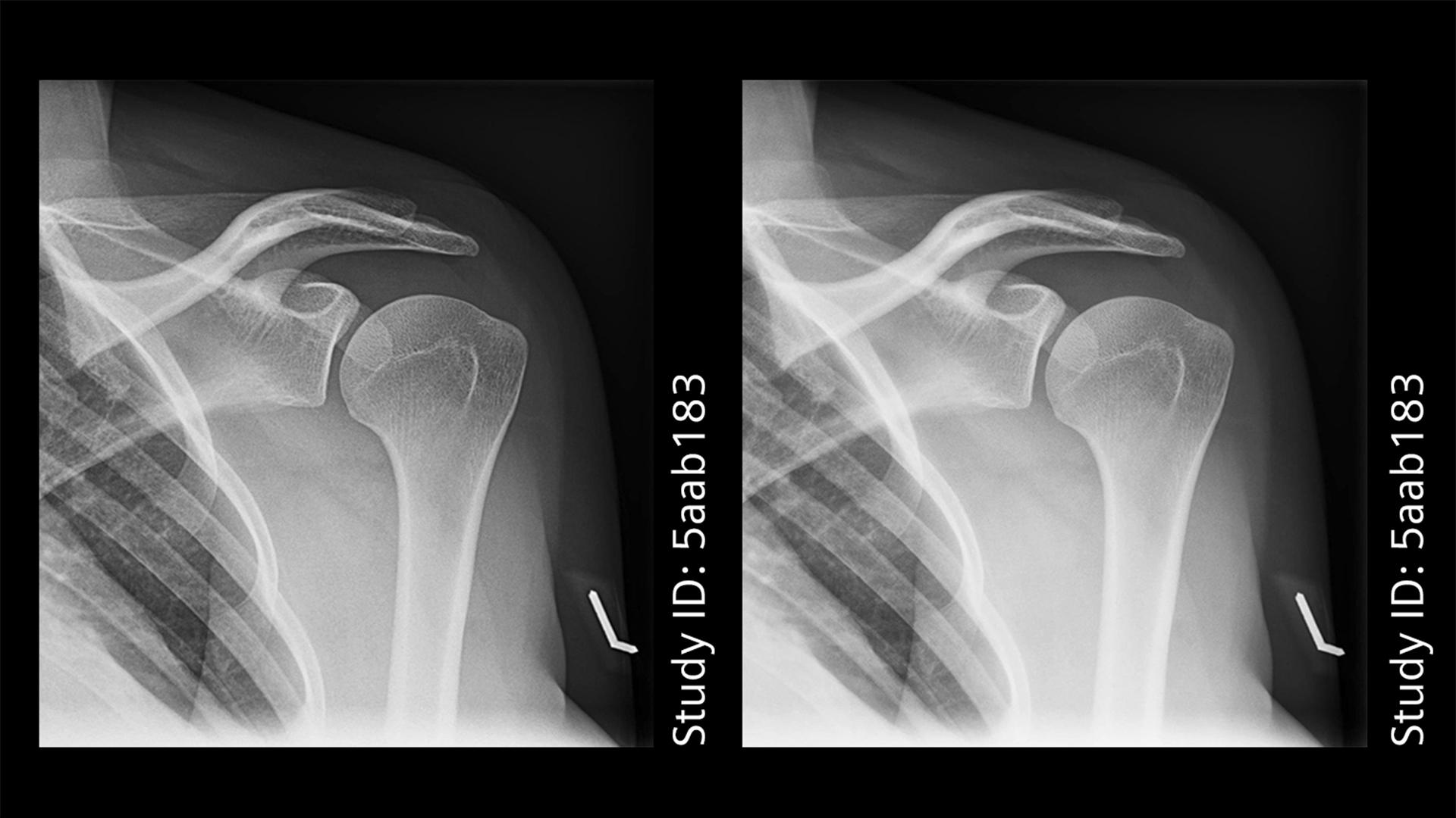 YSIO X.pree – Intelligence for excellence - Siemens Healthineers