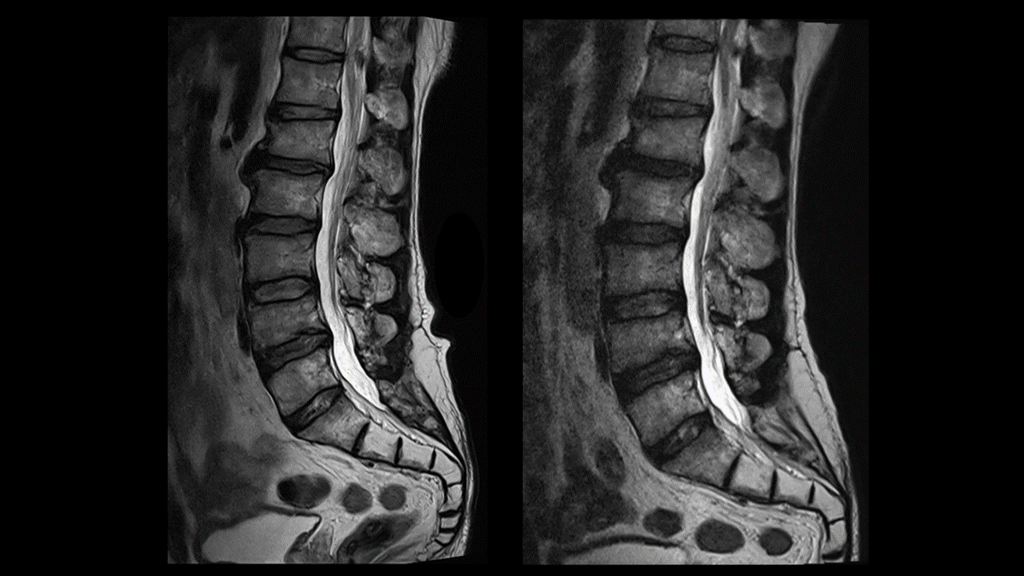 Transforming MSK MRI Scans with Deep Resolve Boost: A Case Study at UMC ...