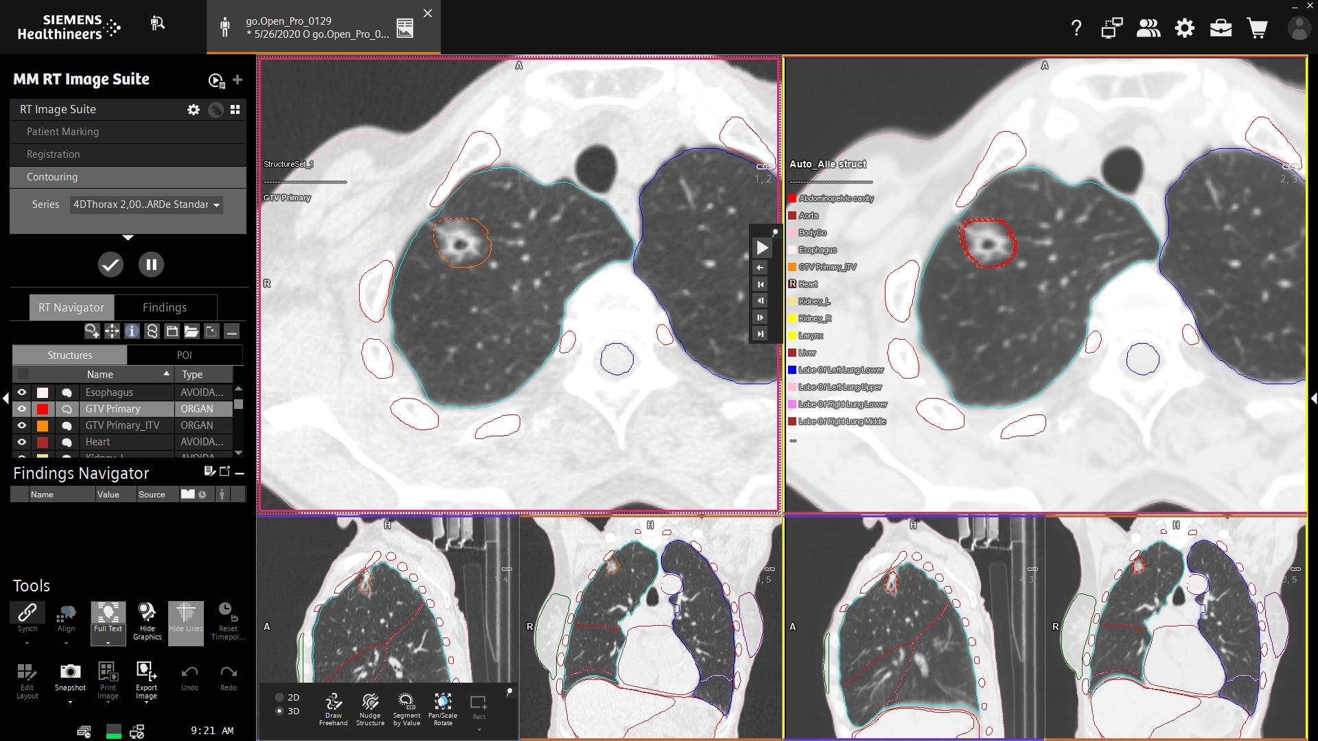 syngo.via RT Image Suite - Siemens Healthineers