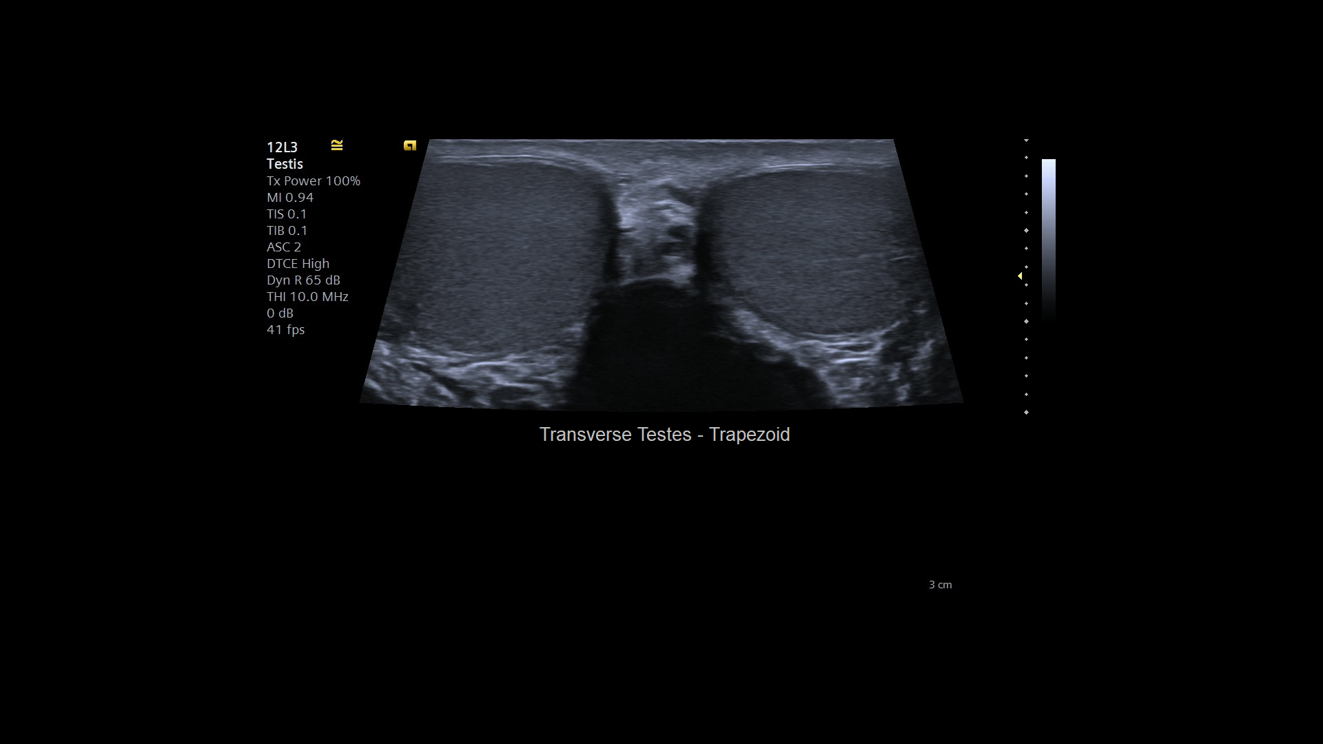 Sistema de Ultrassom ACUSON Juniper - Siemens Healthineers Brasil