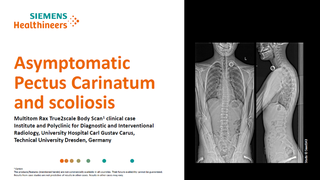 Robotic X-Ray - Clinical Case Library - Siemens Healthineers