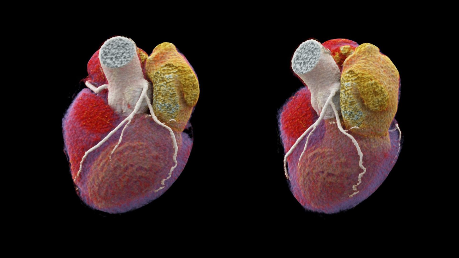 SOMATOM Drive - Siemens Healthineers USA
