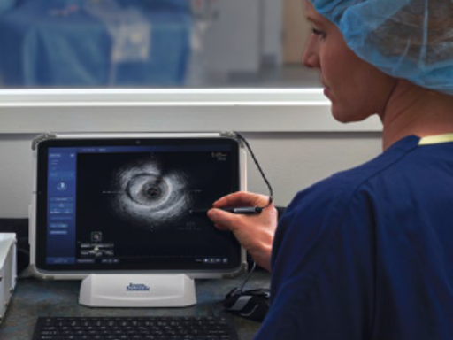 AVVIGO™+ Guidance System - Siemens Healthineers USA