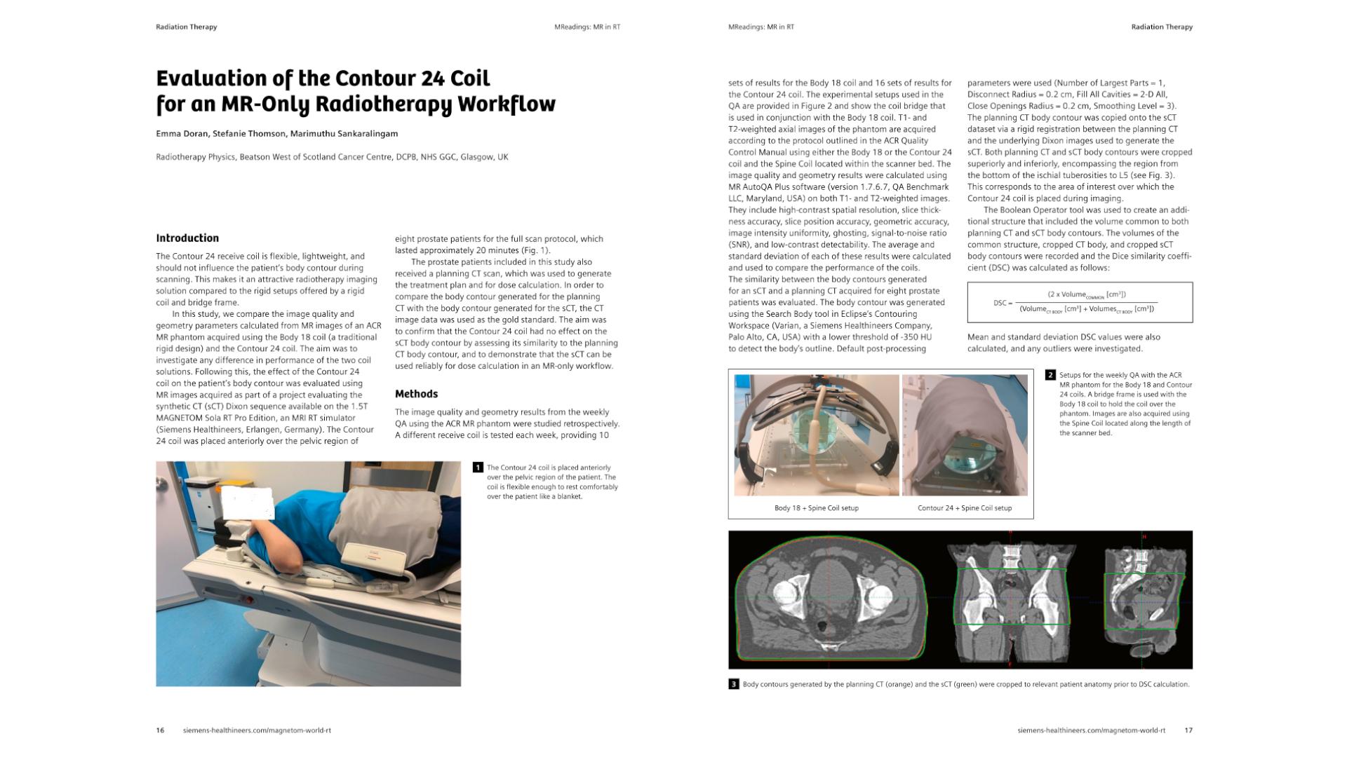 MRI for radiation therapy - Siemens Healthineers