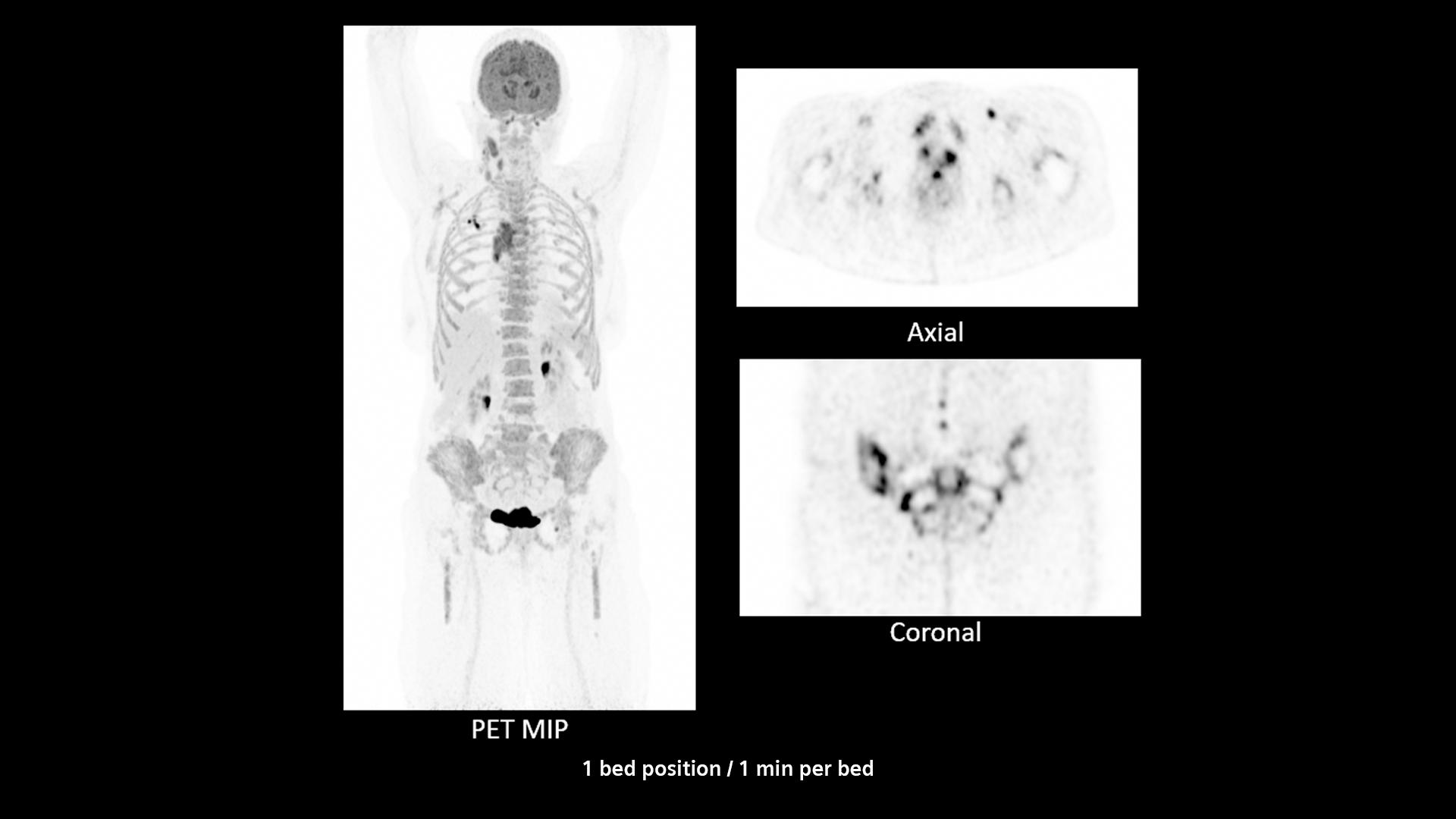 Biograph Vision Quadra PET/CT Scanner - Siemens Healthineers