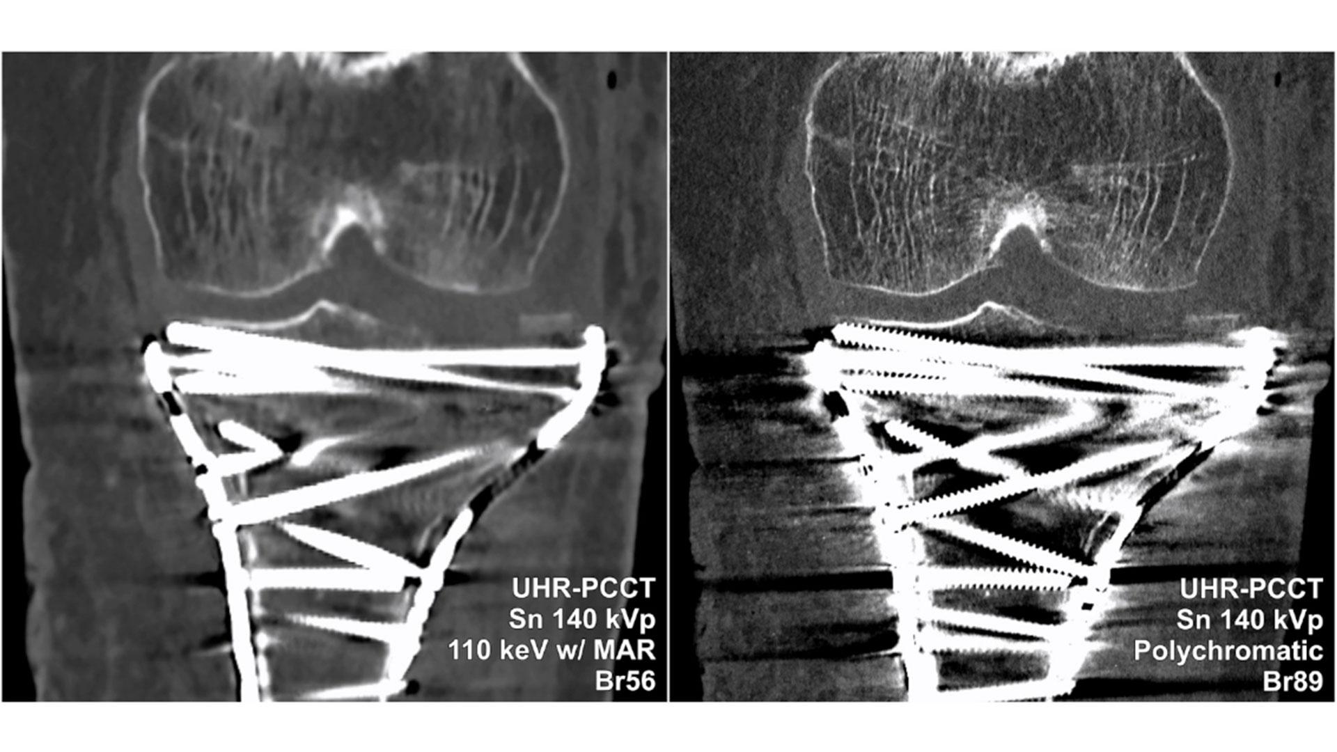 PCCT scientific evidence - Siemens Healthineers