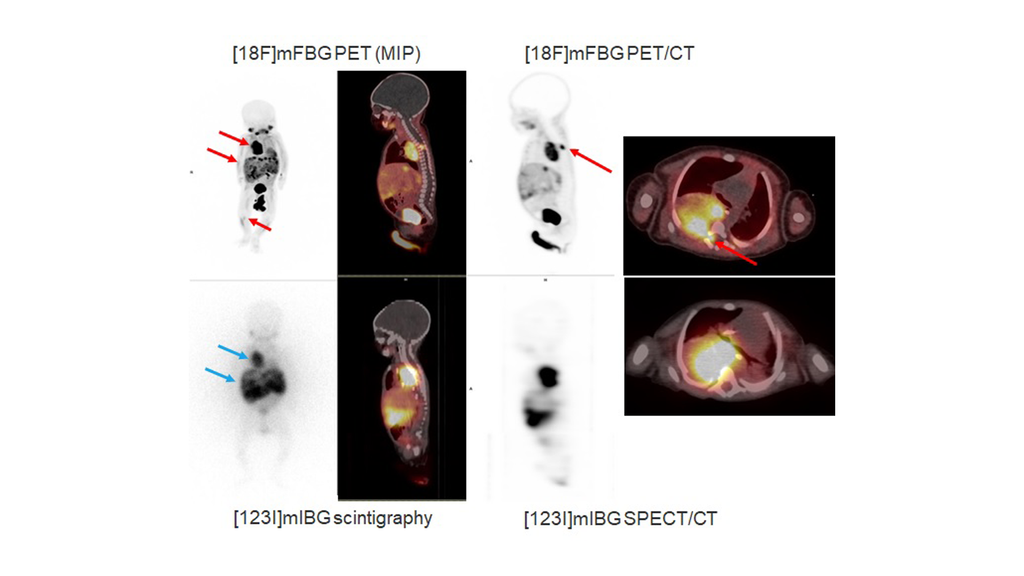 Advancing Pediatric Molecular Imaging - Siemens Healthineers