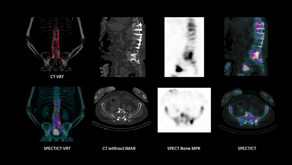Symbia Pro.specta SPECT/CT - Siemens Healthineers